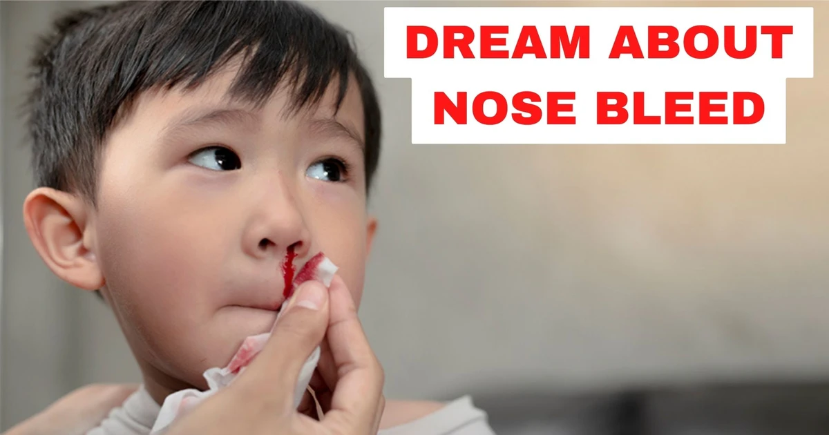 Dream About Nose Bleed - A Bad Sign Of Misfortune