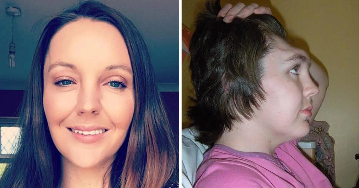 Woman Left With No Forehead Warns Others About Putting Feet On The ...