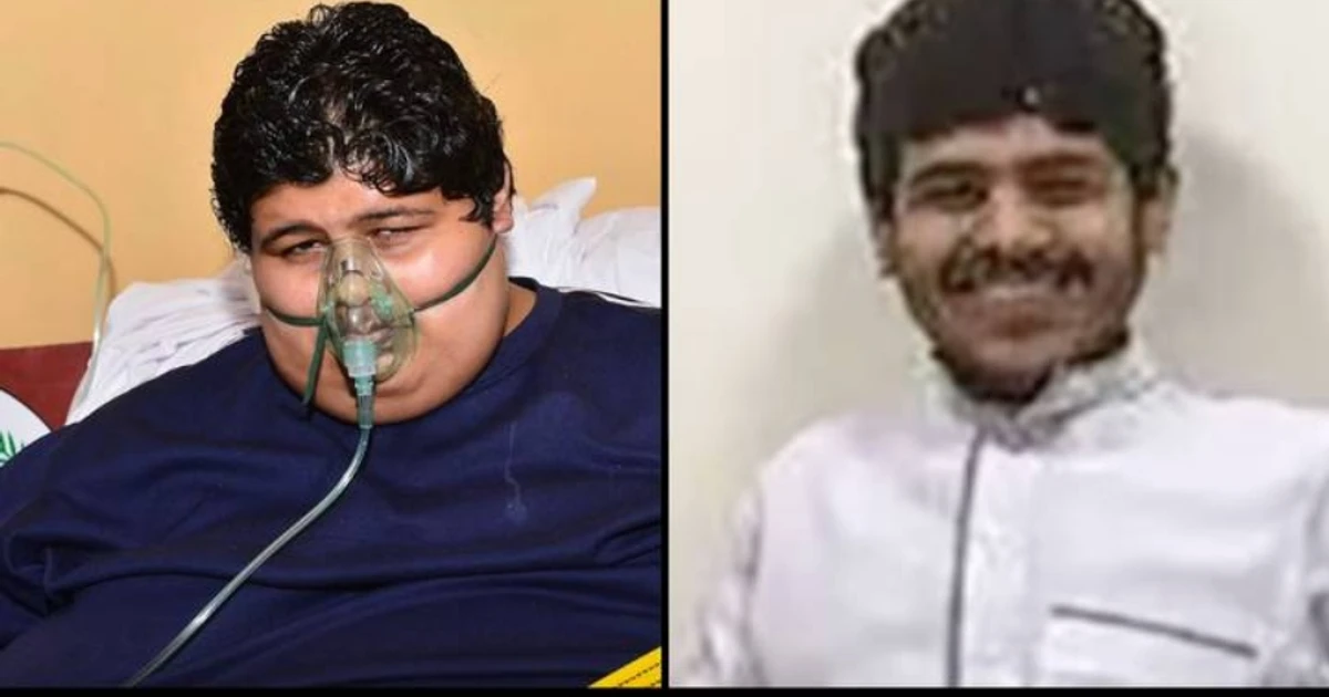 Saudi Man Shows Incredible Transformation After Largest Weight Loss