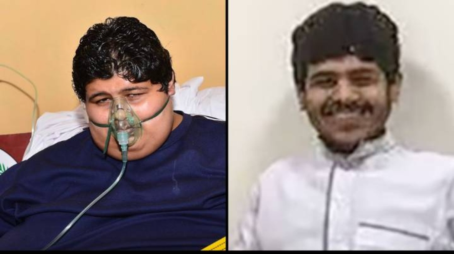 Saudi Man Shows Incredible Transformation After Largest Weight Loss